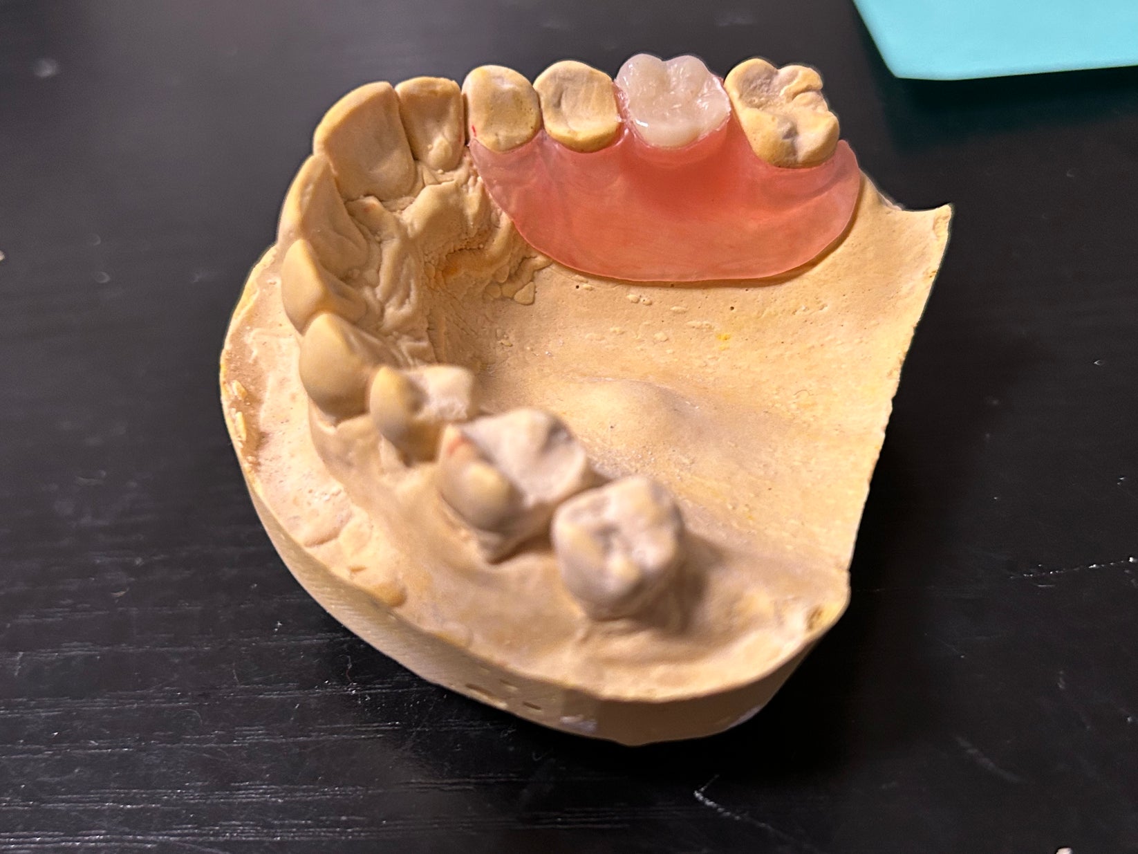 Flexible Nesbit – Dentures 4U